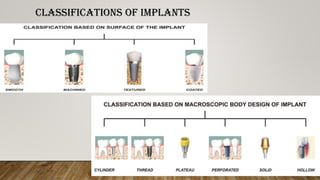 Dental implant instruments | PPTX