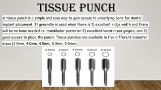 Dental implant instruments | PPTX