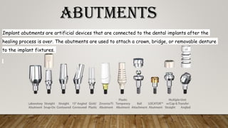 Dental implant instruments | PPTX