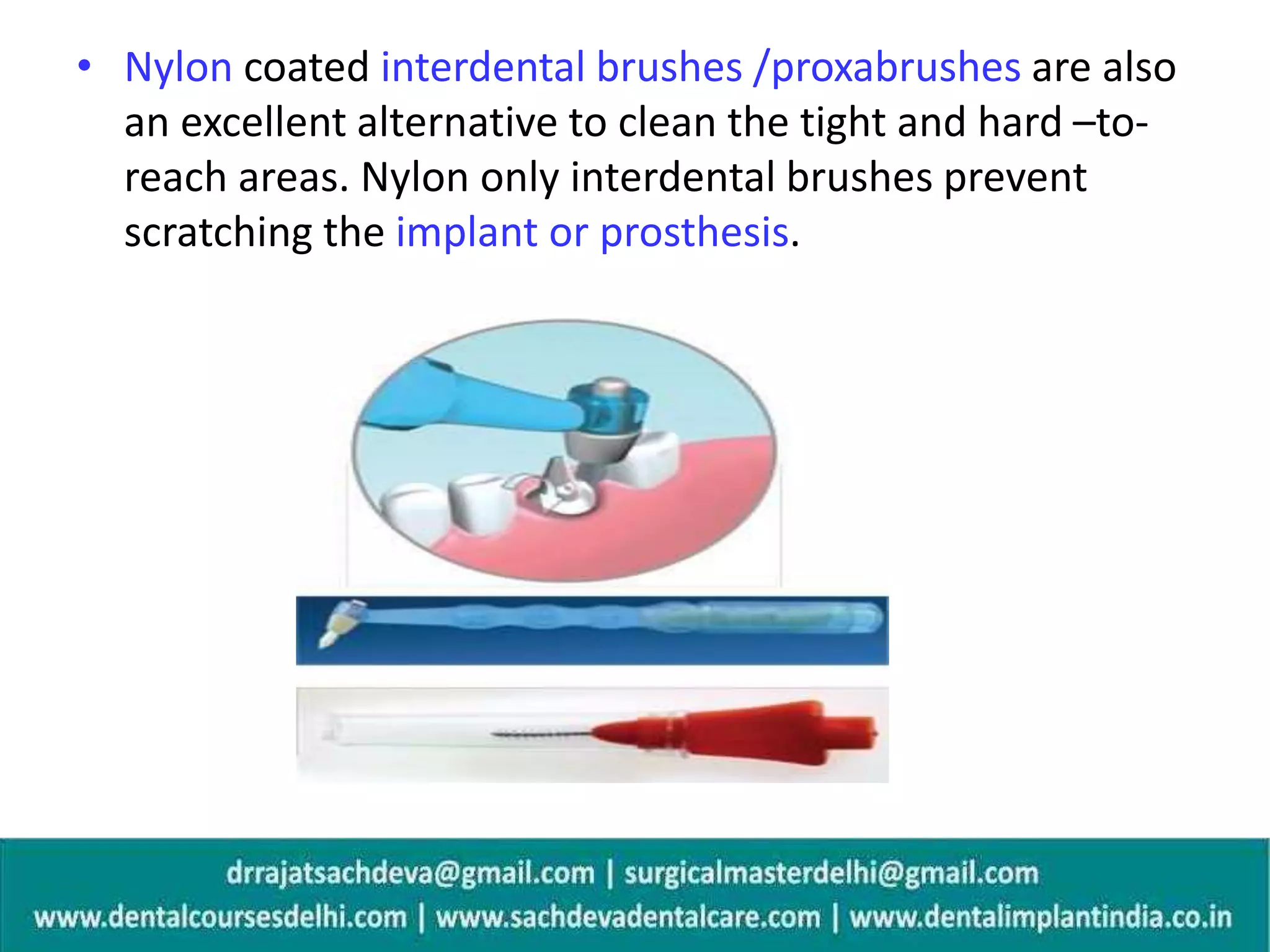 Dental Implant Maintenance , Dental Implant Care | PPTX