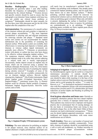 Dental implant maintenance_a_critical_factor_in_long_term_treatment ...