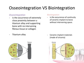 Dental implants | PPTX | Oral care | Personal Care