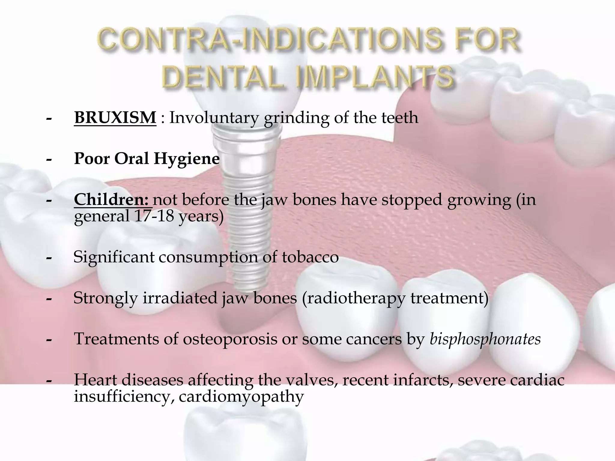 Dental implants | PPT