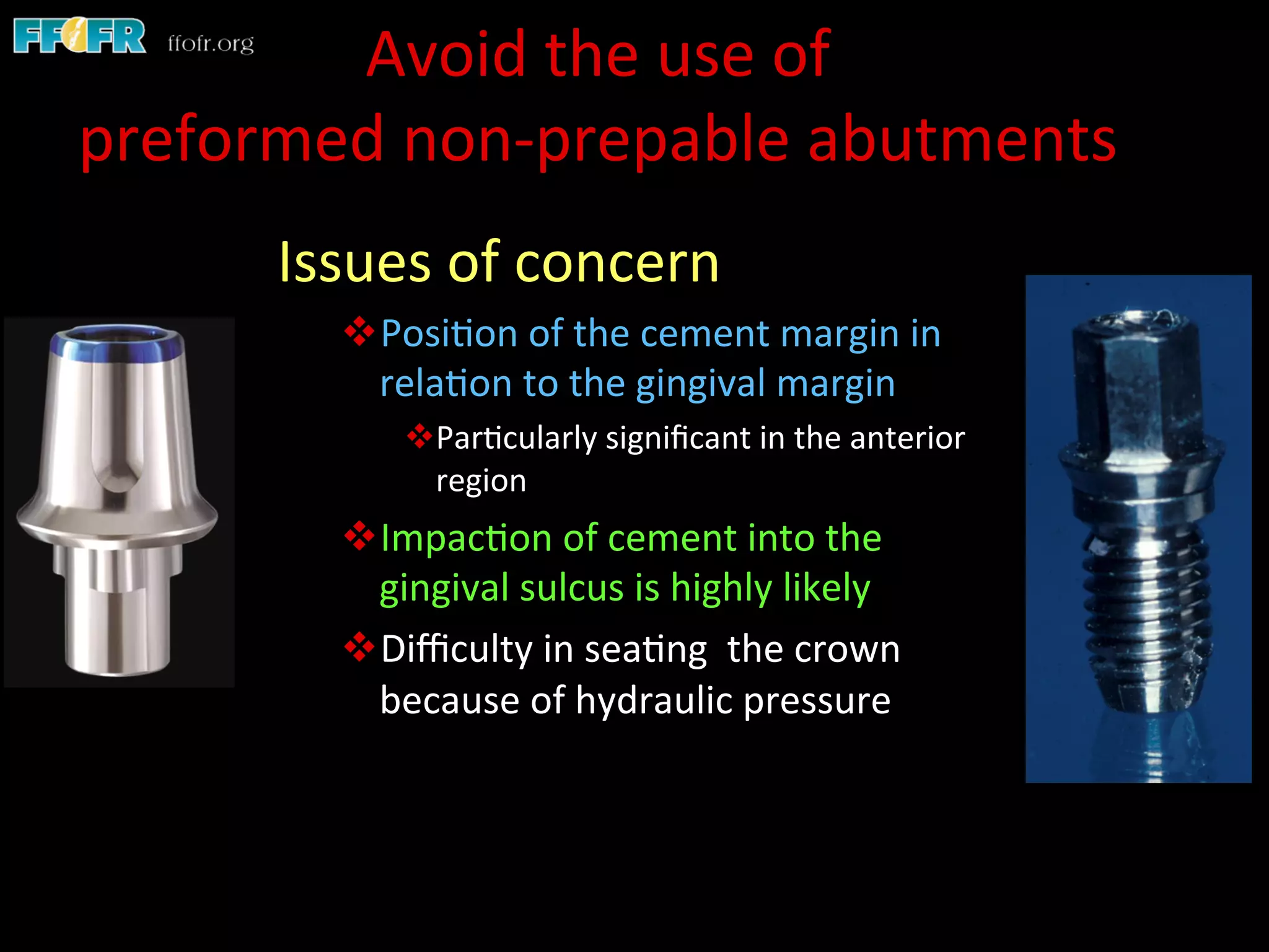 Dental implants cement retention vs screw retention | PDF