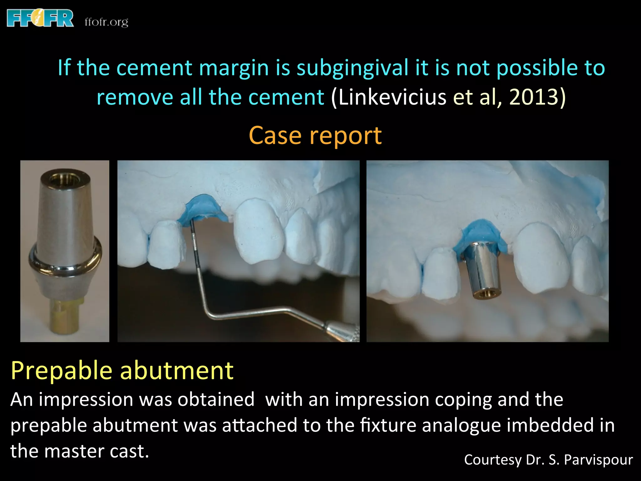 Dental implants cement retention vs screw retention | PDF