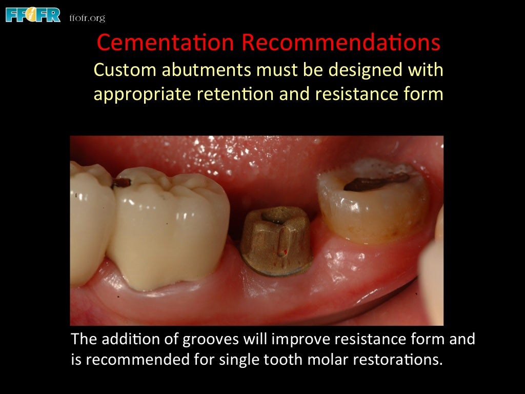 Dental implants cement retention vs screw retention