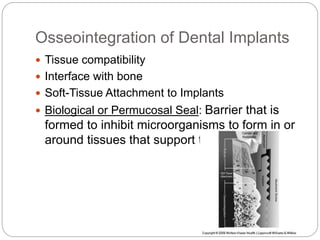 Dental Implants Chapter 12 | PPTX