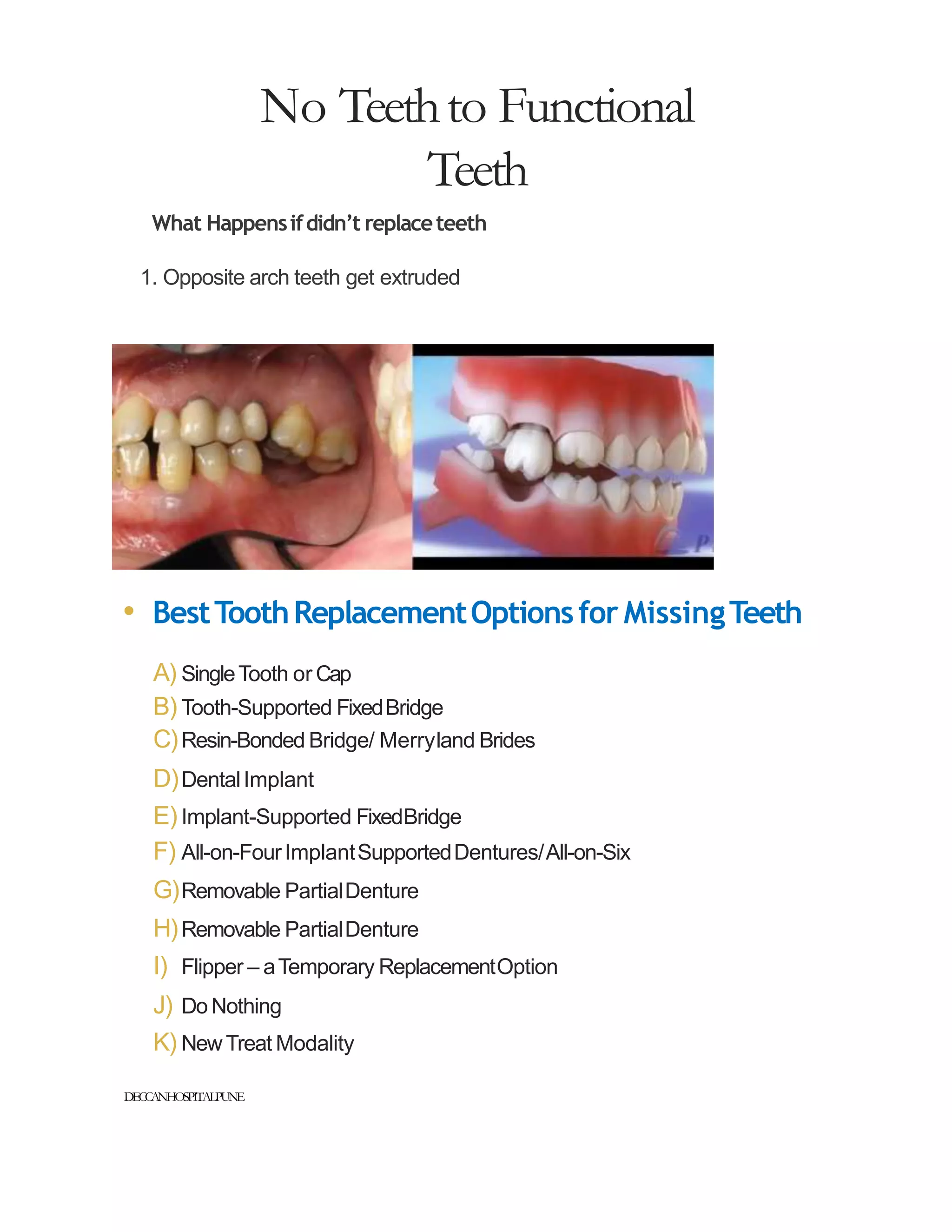 Dental implant - permanent teeth replacement types, advantage ...