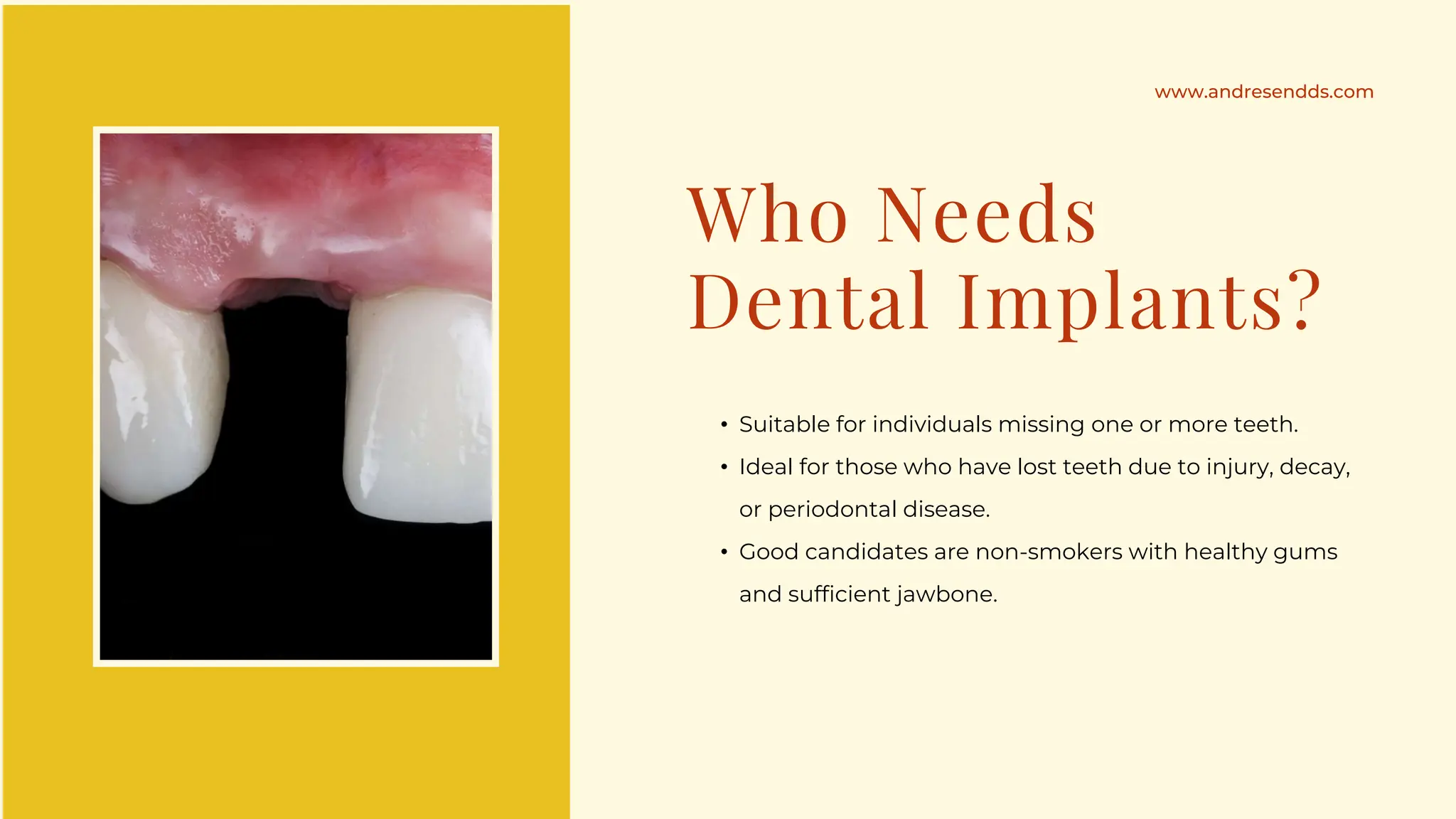 Dental Implants: A Comprehensive Overview.pptx