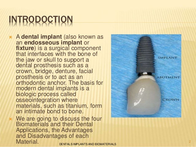 Dental implants and biomaterials
