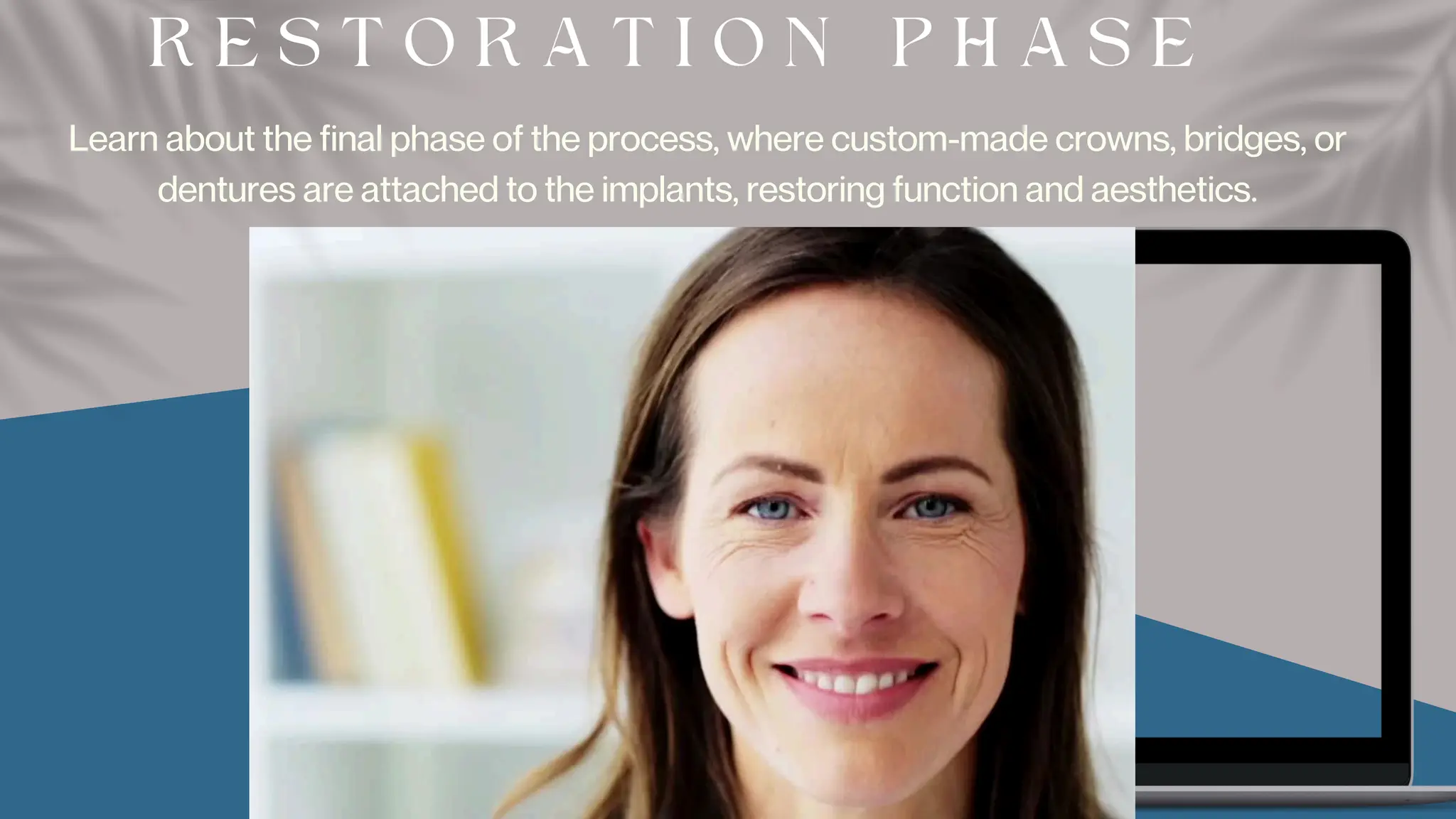 Dental Implants From Consultation to Restoration.pdf