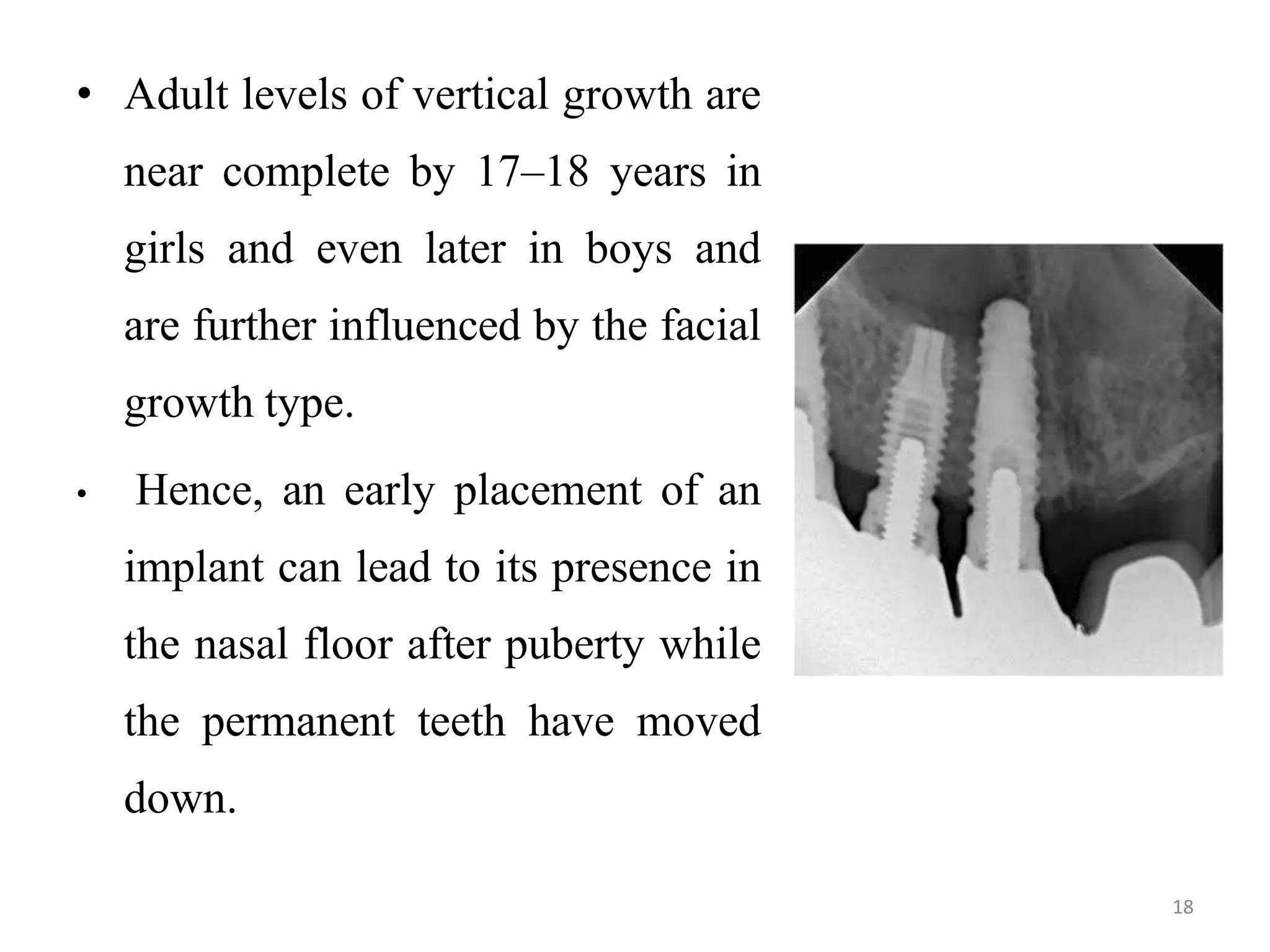 dentalimplantsinpediatricdentistry-200416151954.pptx | Dental Health ...