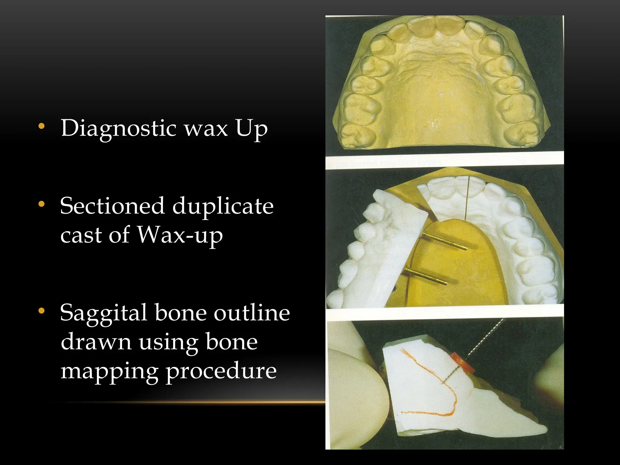 the dental implants surgical basics .pptx
