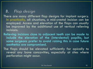 Dental implant surgery | PDF