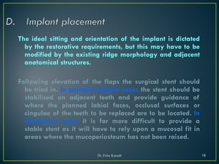 Dental implant surgery | PDF