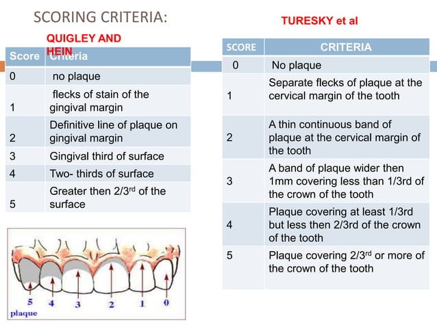 Periodontal indices | PPT