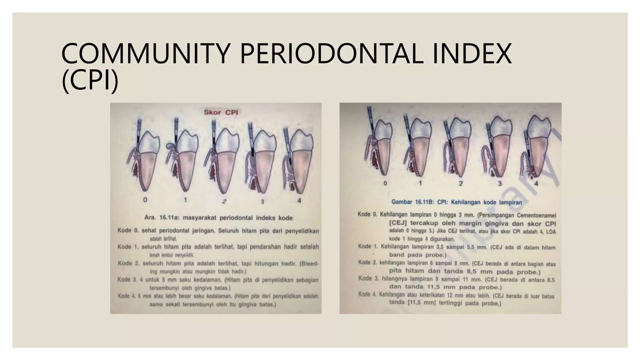 Dental Indices (Indeks Pemeriksaan Jaringan Penyangga / Periodontal ...
