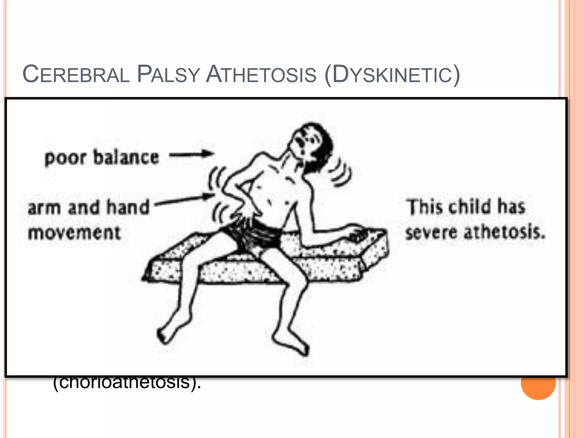 Dental management downs syndrome, fetal alcohol syndrome | PPTX