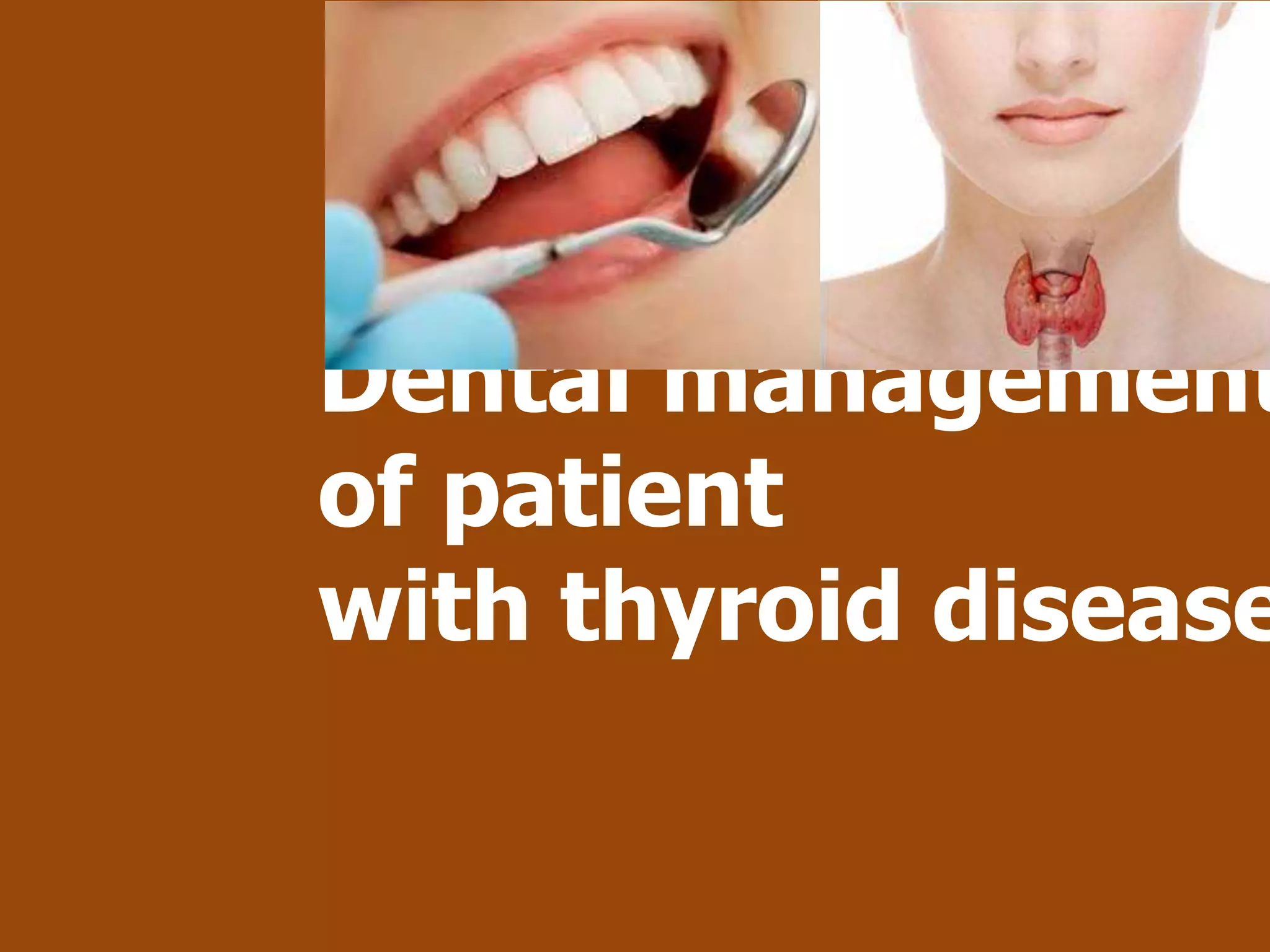 Dental management in thyroid patient | PPTX