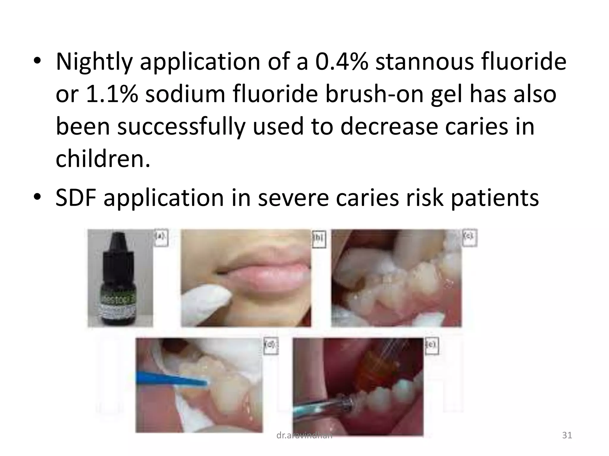 Dental management of children with special health care needs | PPTX