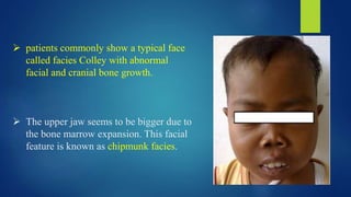 Dental Management Of Patient With Thalassemia.pptx