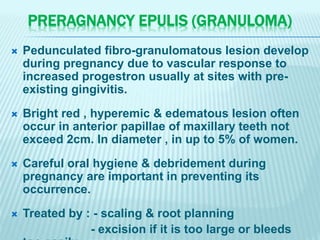 Dental management of pregnant women | PPTX