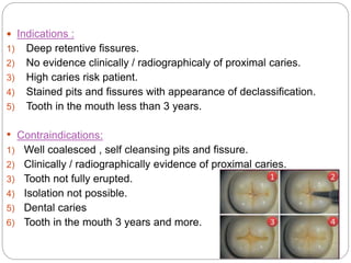 Dental restorative material in pediatric dentistry | PPTX