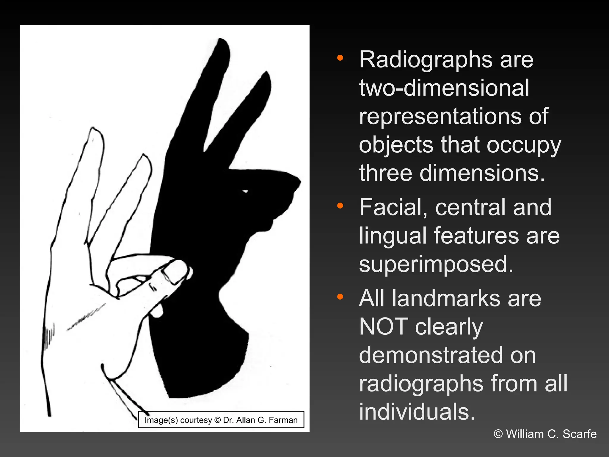 Dental Maxillary and Mandibular Anatomic Radiographic Landmarks.ppt