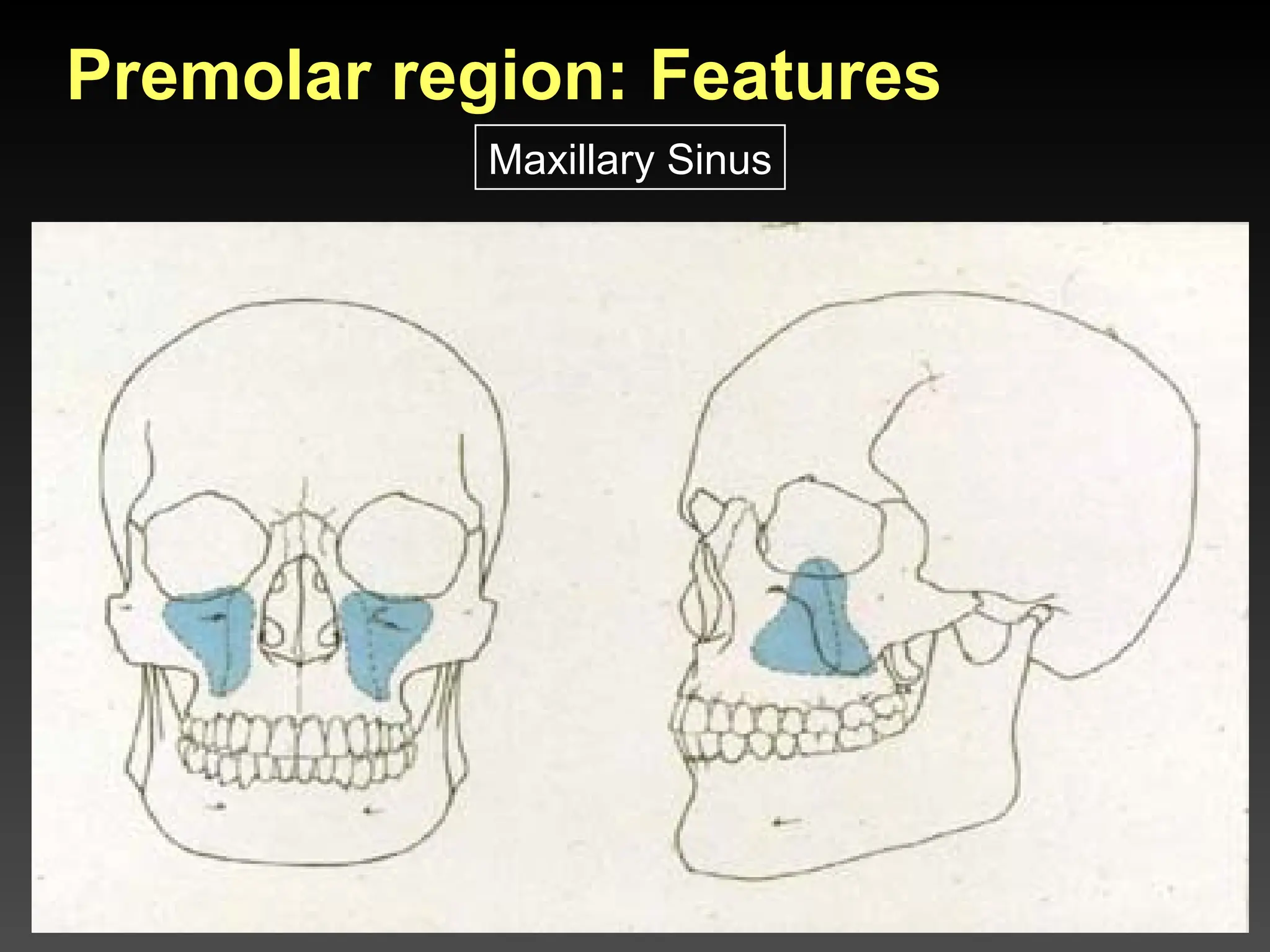 Dental Maxillary and Mandibular Anatomic Radiographic Landmarks.ppt