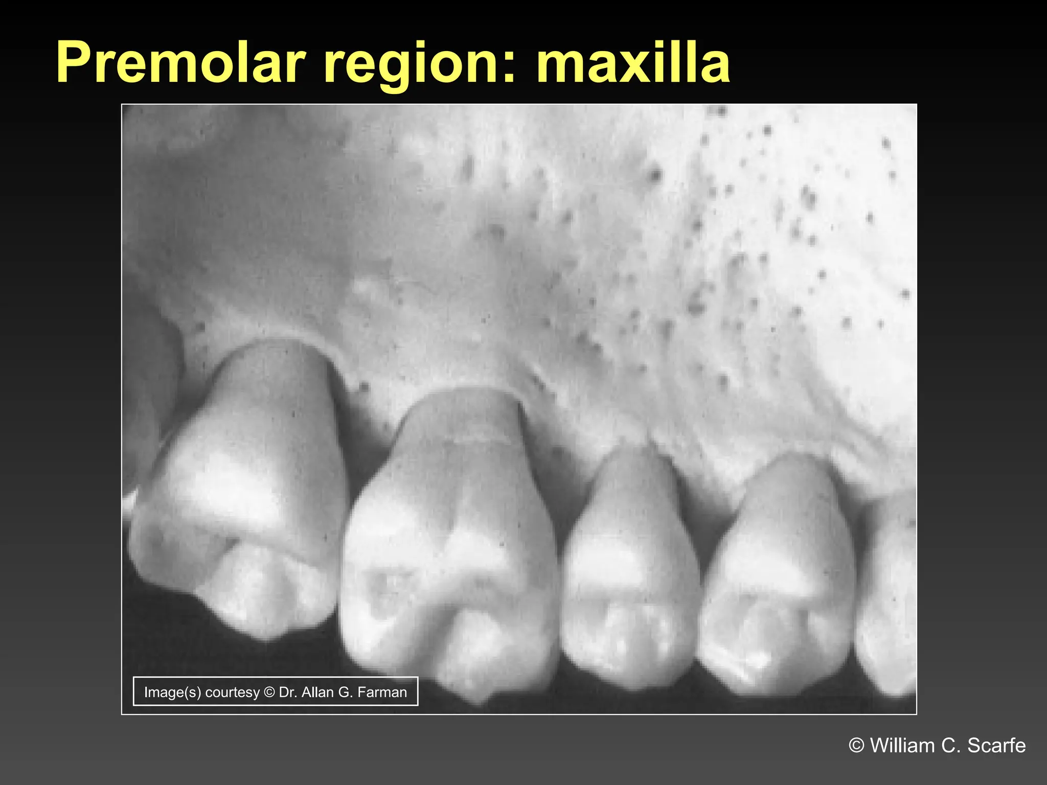 Dental Maxillary and Mandibular Anatomic Radiographic Landmarks.ppt | 3 ...
