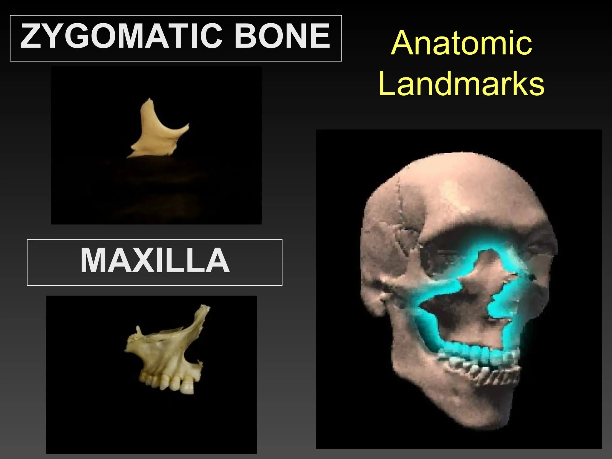 Dental Maxillary and Mandibular Anatomic Radiographic Landmarks.ppt