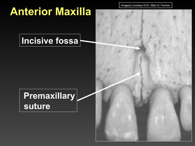 Dental Maxillary and Mandibular Anatomic Radiographic Landmarks.ppt | 3 ...