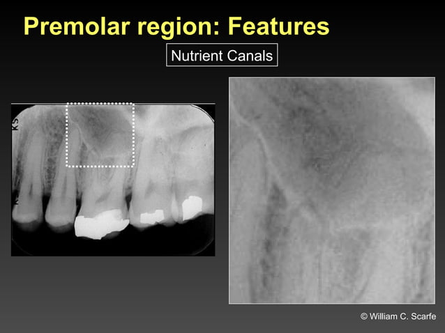 Dental Maxillary and Mandibular Anatomic Radiographic Landmarks.ppt | 3 ...