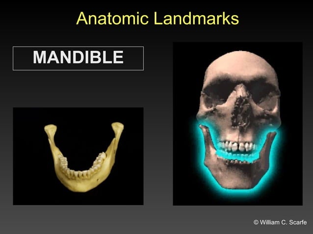Dental Maxillary and Mandibular Anatomic Radiographic Landmarks.ppt | 3 ...