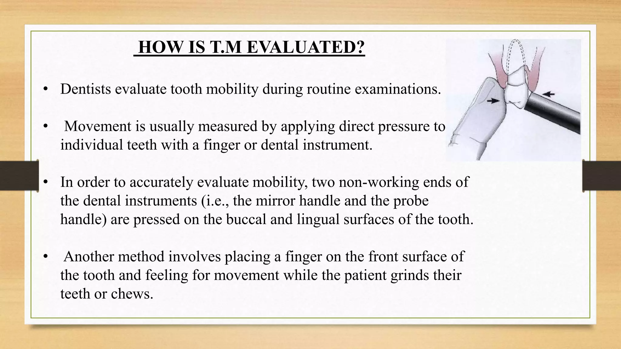 Dental mobility | PPTX