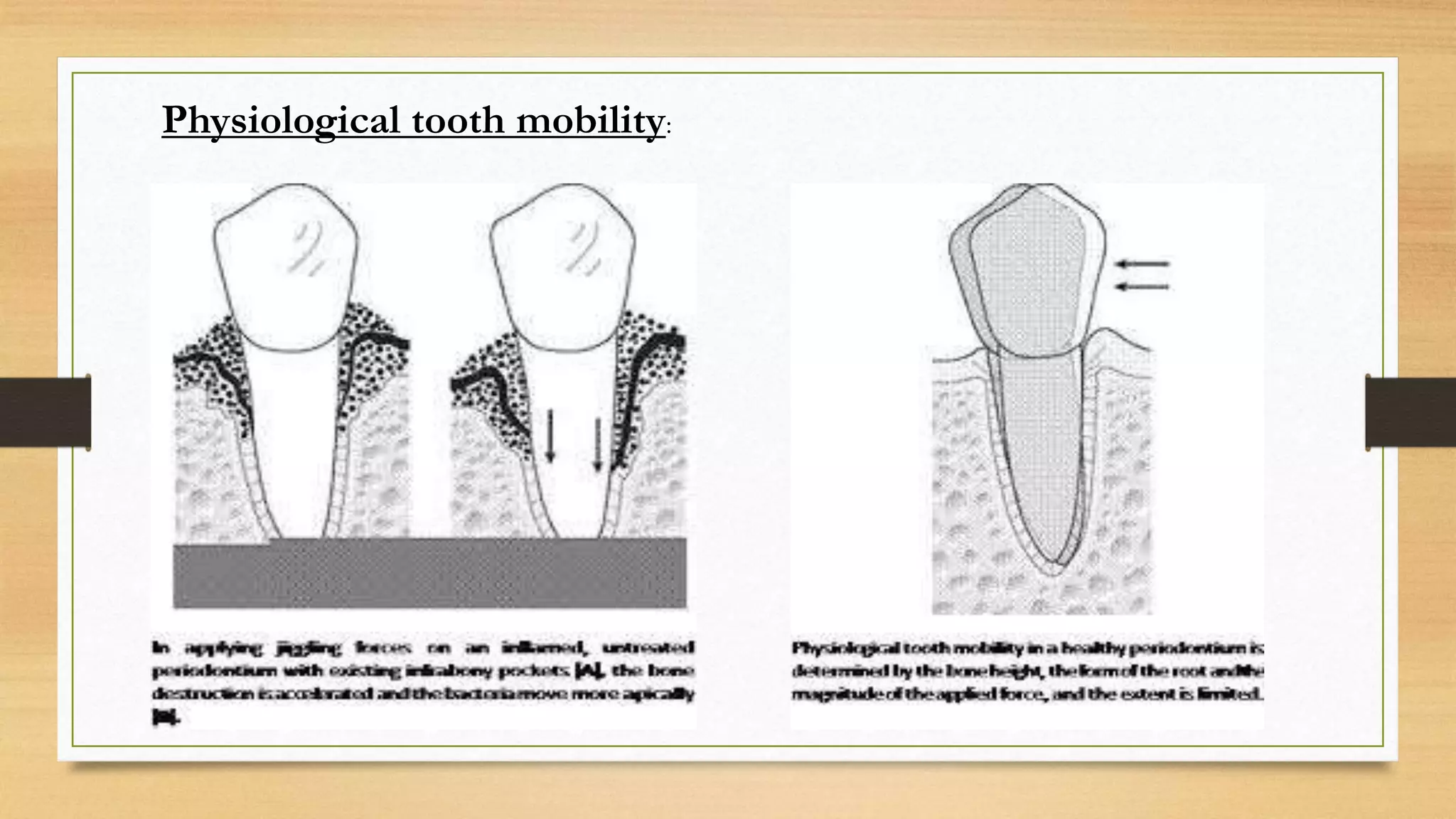 Dental mobility | PPTX