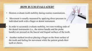 Dental mobility | PPTX