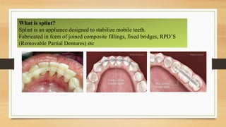 Dental mobility | PPTX