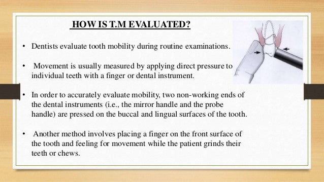 Dental mobility