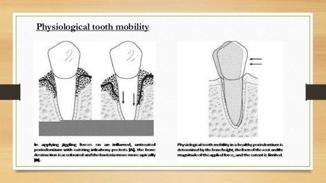 Dental mobility