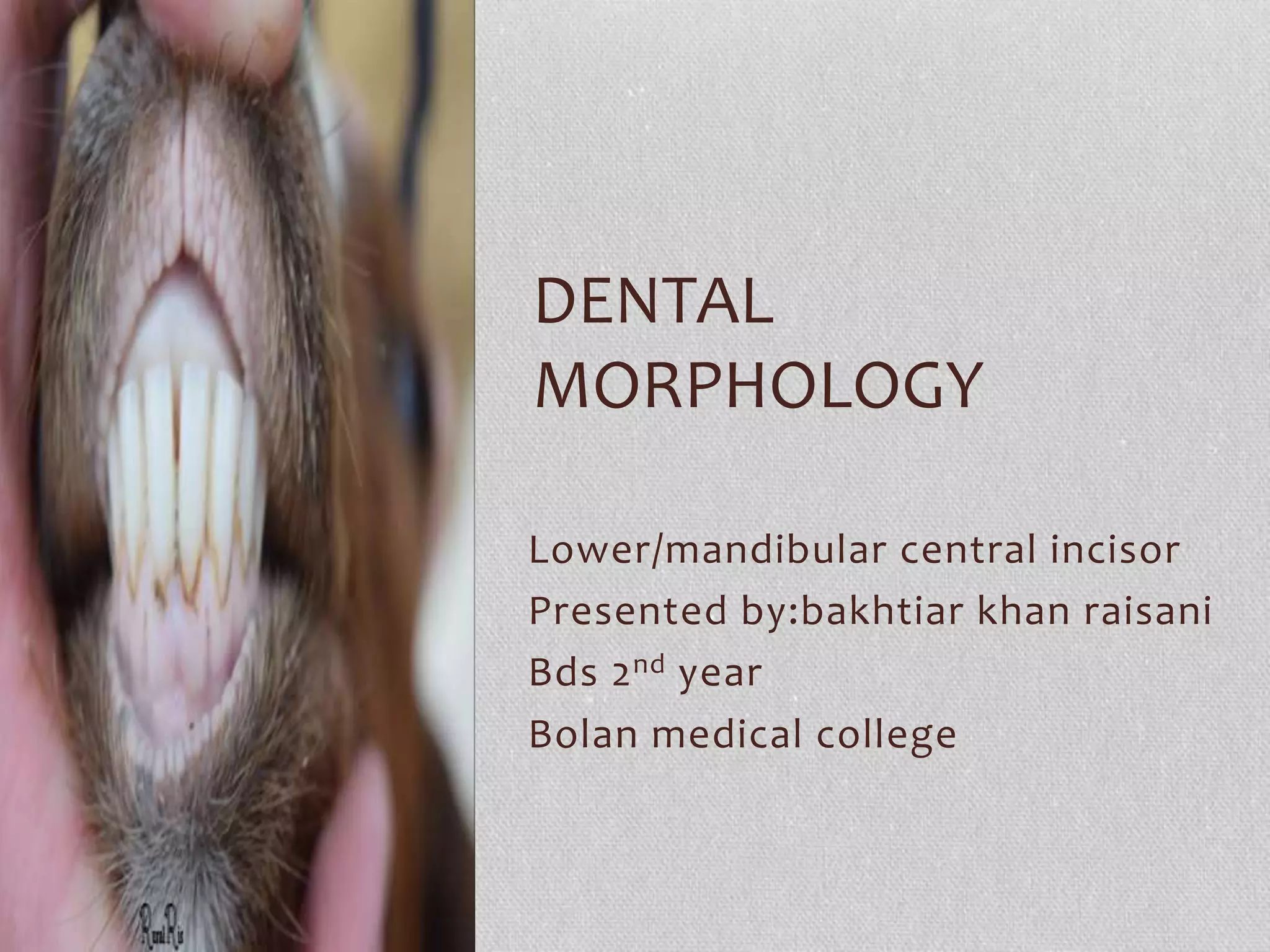 lower/mandibular central incisor | PPT