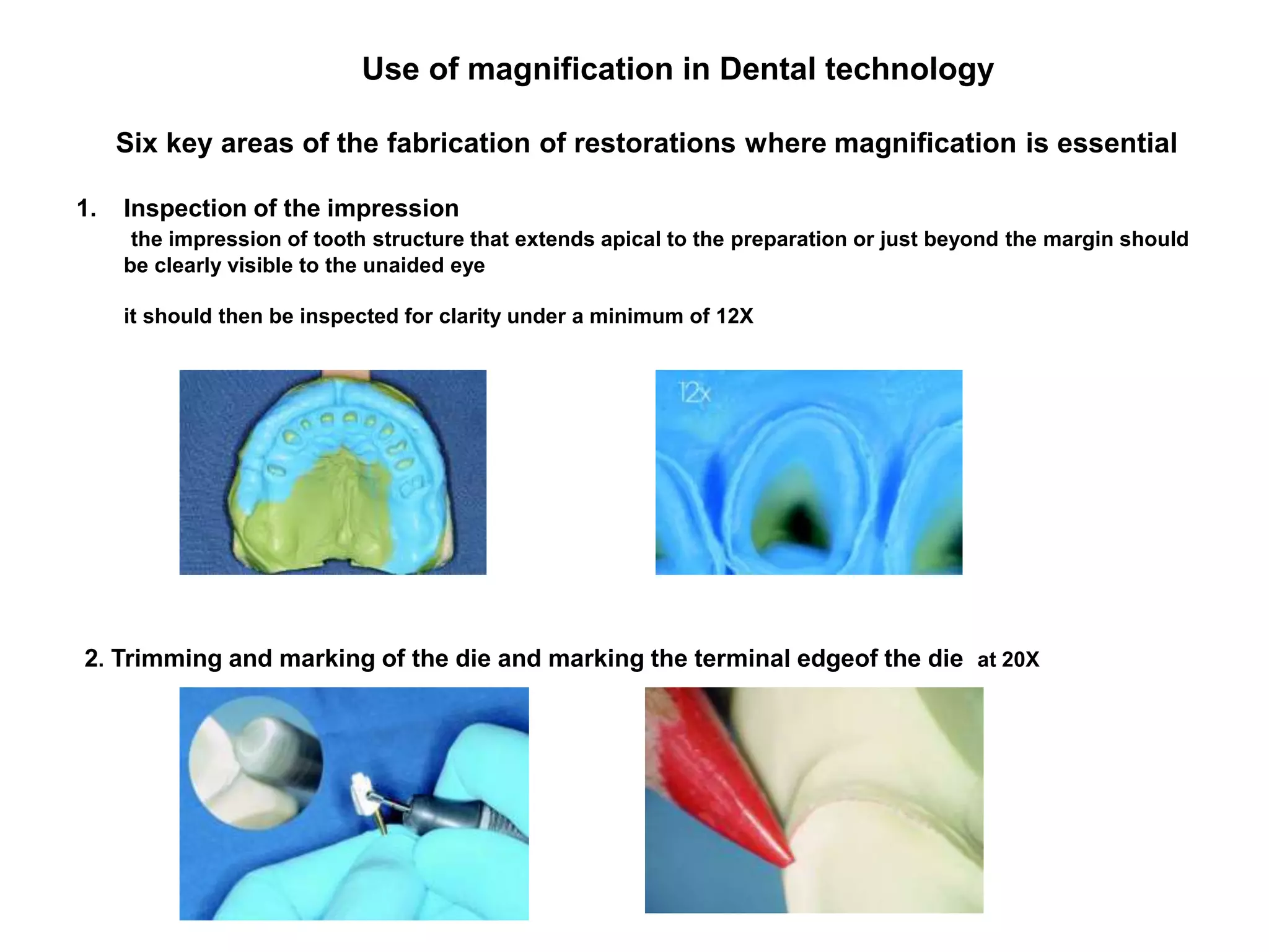 dental operating microscope.ppt
