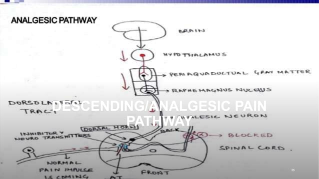 Facial/Dental Pain Pathway and Atypical Odontalgia | PPTX | Dental ...