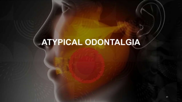 Facial/Dental Pain Pathway and Atypical Odontalgia | PPTX | Dental ...