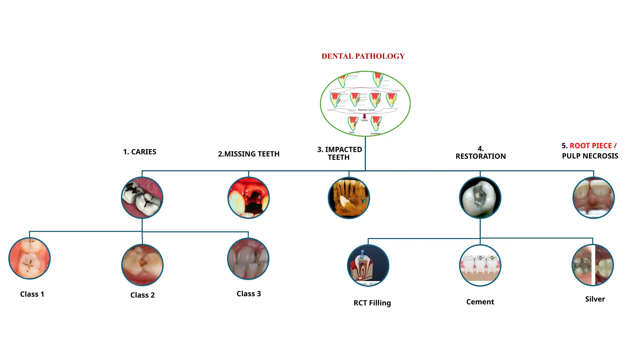 DENTAL PATHOLOGY TYPES Digram caries.pptx