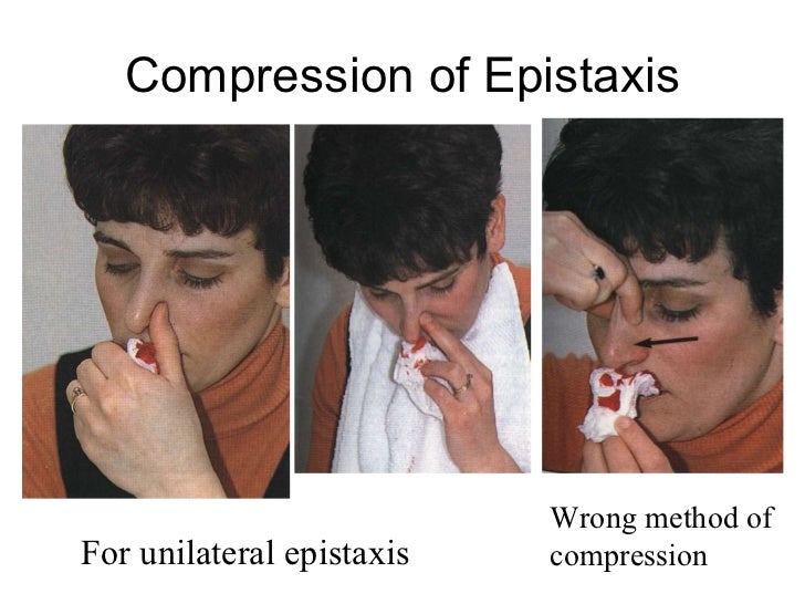 Dental Presentation E.N.T.