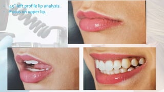 dental photography.pptx