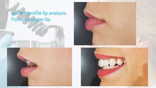 dental photography.pptx