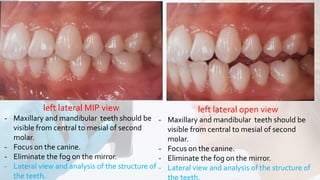 dental photography.pptx