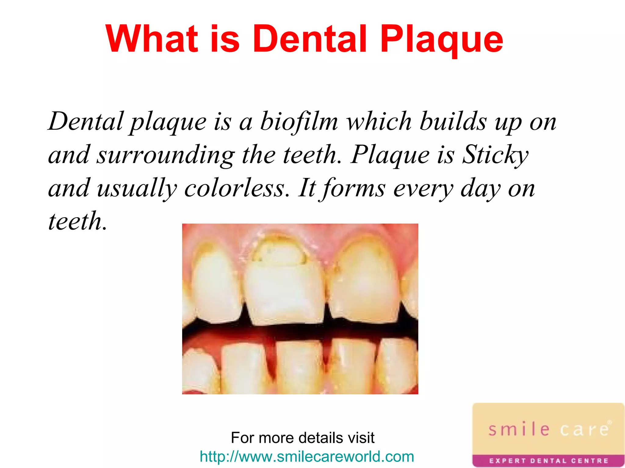 Dental plaque | PPT